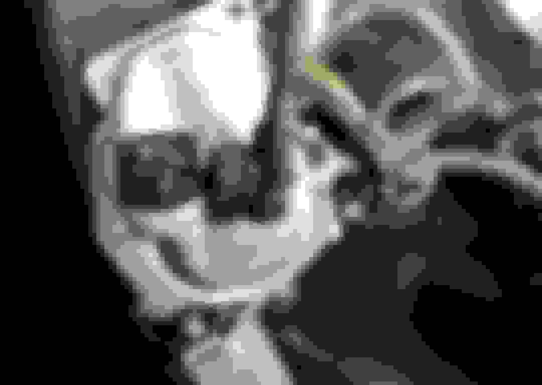 Rear view Camera replacement 2017 Q7 - Page 2 - AudiWorld Forums