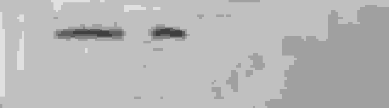 2018 Q7 acceleration noise - Page 3 - AudiWorld Forums