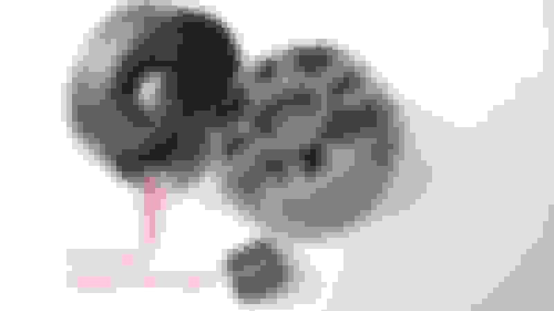 KR: Understanding the torque distribution principle of the Audi Torsen ...